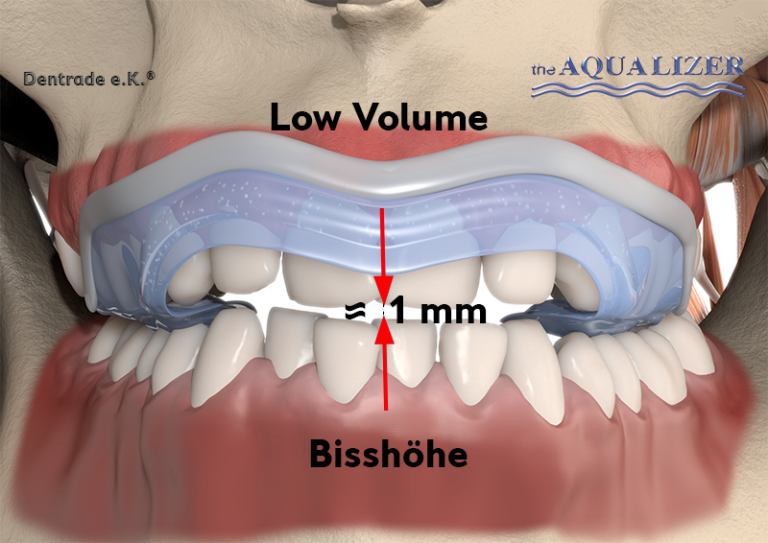 Aqualizer CMD Sofort-Hilfe-Schiene | Snorflex®